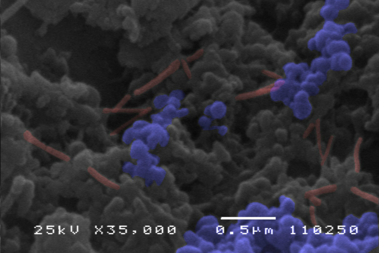 A Close Look at the Workings of Antimicrobial Filtration Media ...