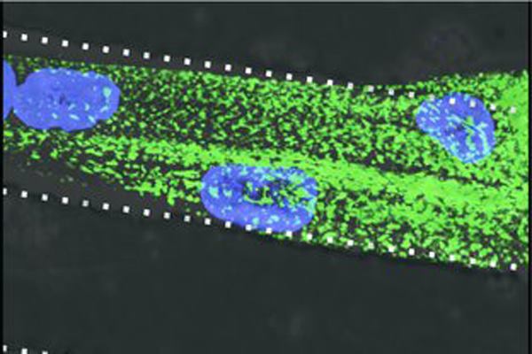 Scientists Engineer Artificial Muscle Tissue | Architect Magazine